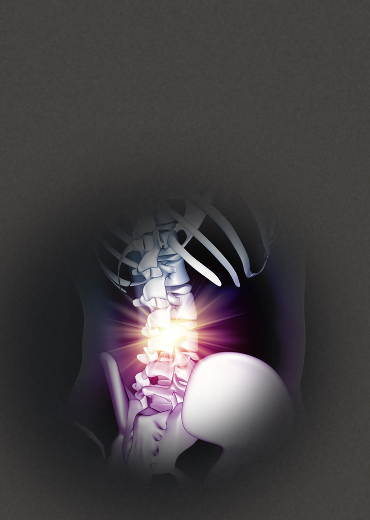 Jared Ament - Amir Vokshoor | Brain Spine Surgeons West Hills